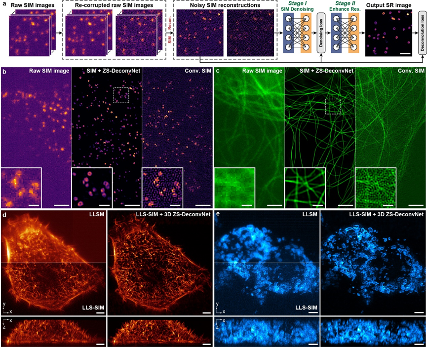 Nature Communications| Zero-shot learning enables instant denoising and super-resolution in ...