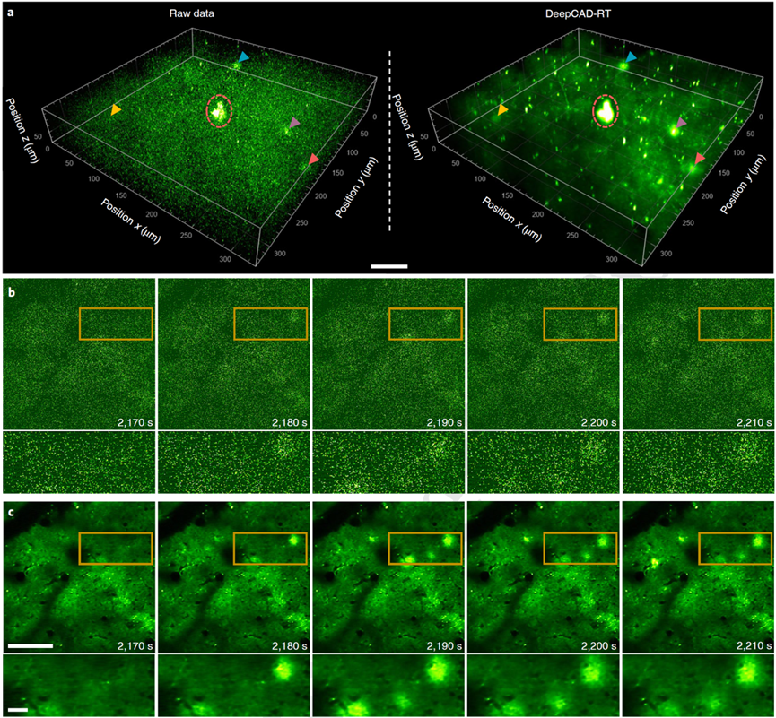 Nature Biotechnology | Real-time denoising enables high-sensitivity ...